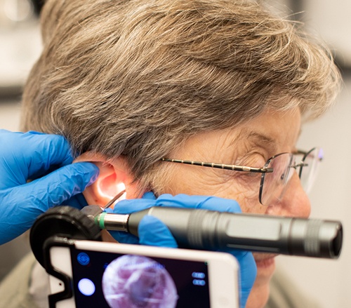 Ear Wax Removal | Biddulph Hearing Centre